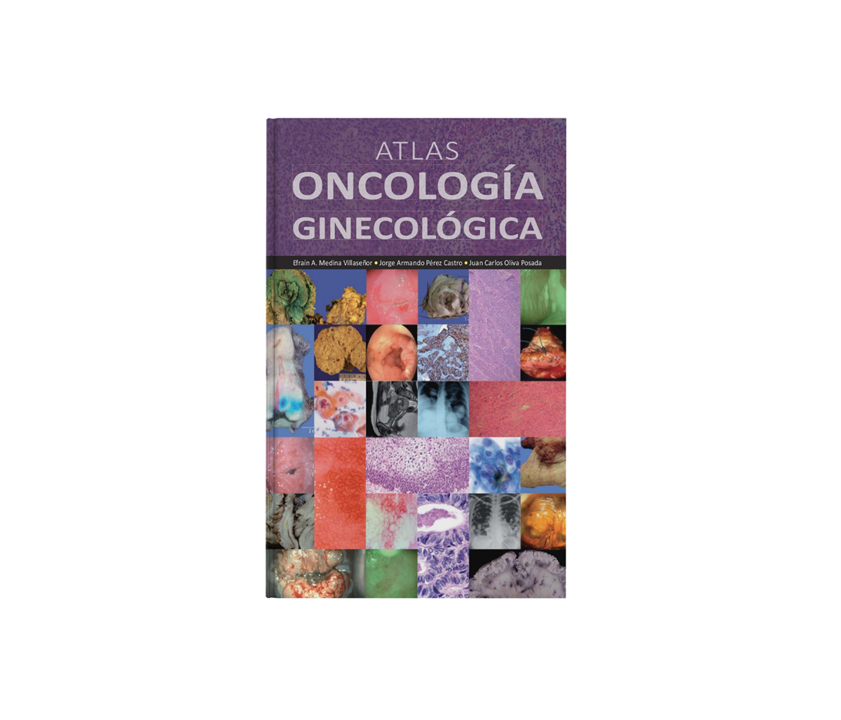 Libros - Cáncer y Oncología Medina